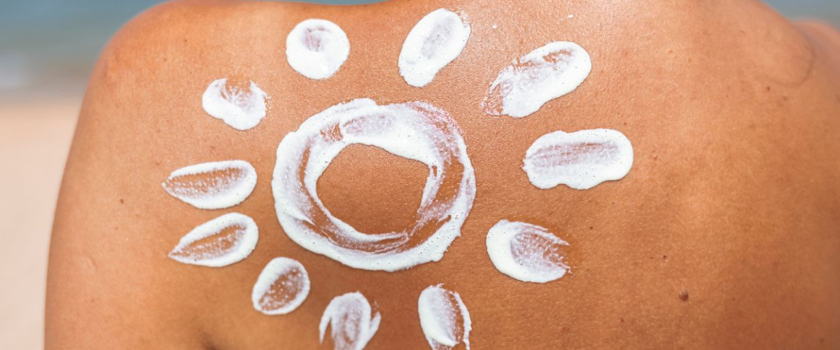 Qué hacer (y qué no) cuando te quemas con el sol: guía veraniega de ...