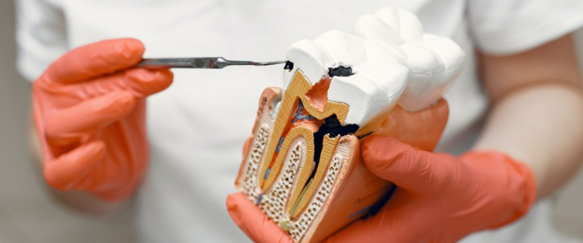 De la médula ósea y el cordón umbilical, a las piezas dentales: nuestra ...